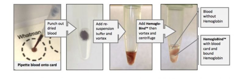 Hemoglobin is a protein in High Hemoglobin Count - Kash Biotech Express